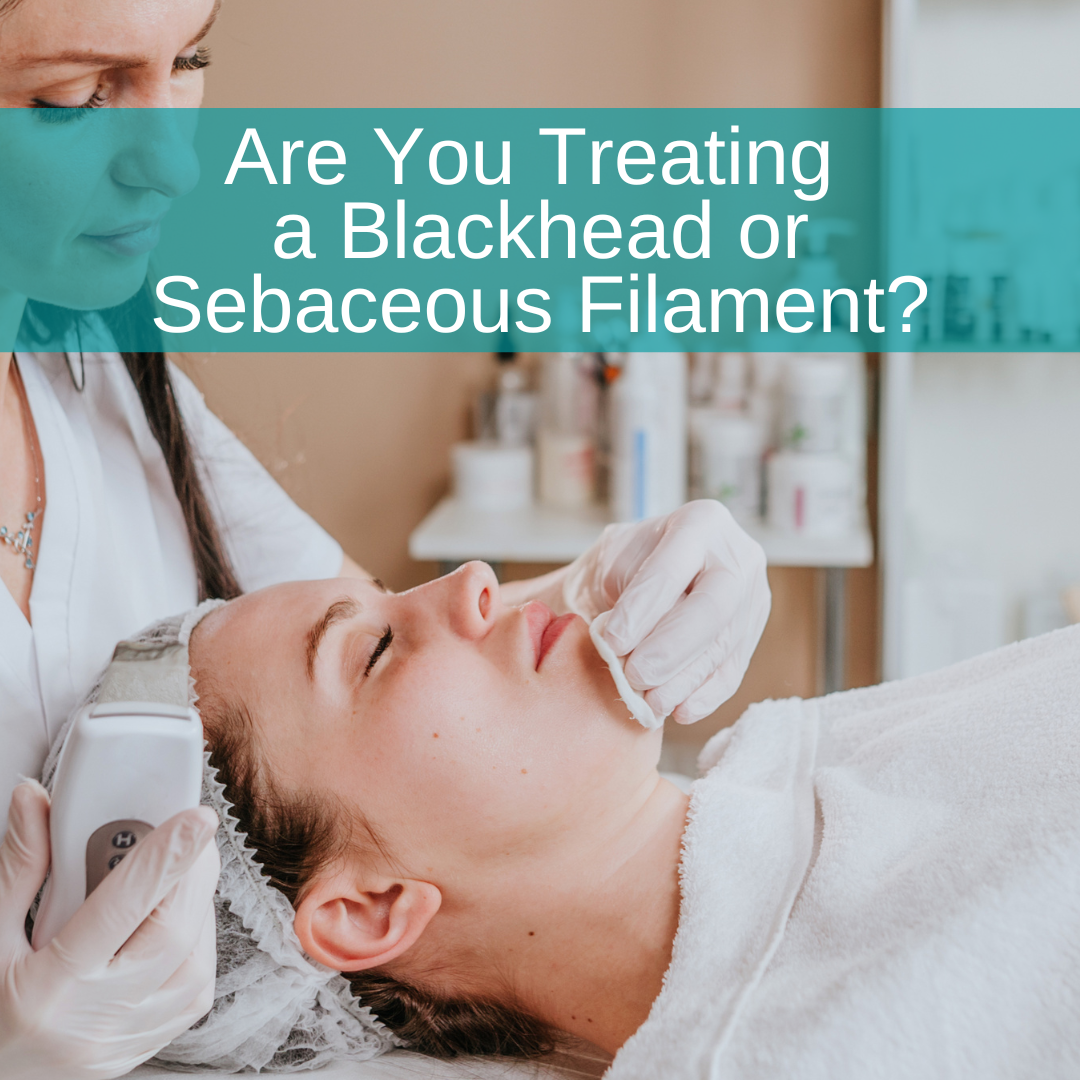 Are You Treating a Blackhead or Sebaceous Filament? – Christine Byer ...