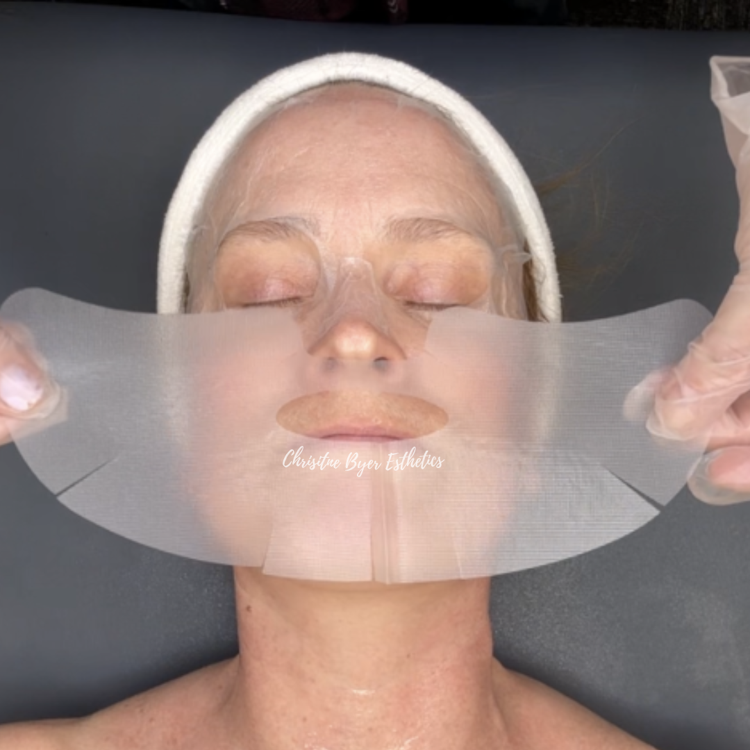 Restore Facial Volume Without Fillers Using PLLA | Christine Byer Esthetics