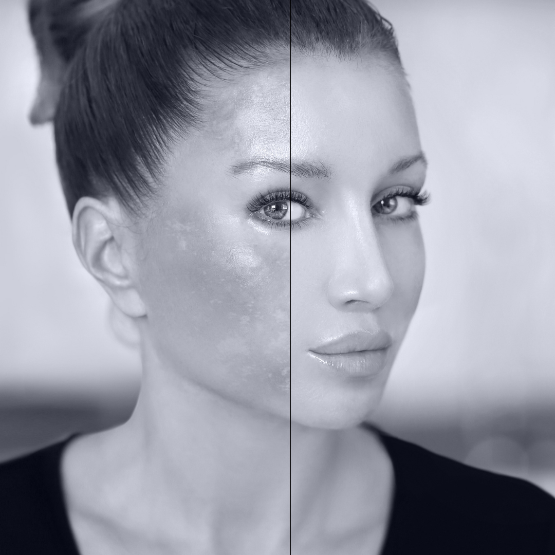 How to Lighten Sun Spots Without Harsh Treatments | Christine Byer ...