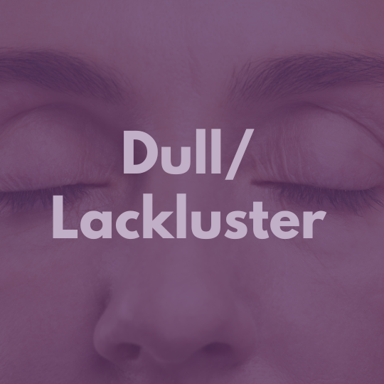 Dull/Lackluster – Christine Byer Esthetics