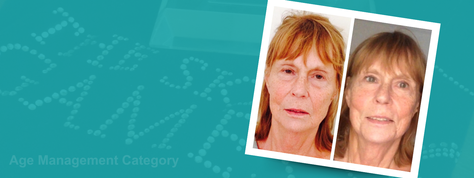 Anti-Aging Transformation with Microcurrent, LED & Massage - Christine ...