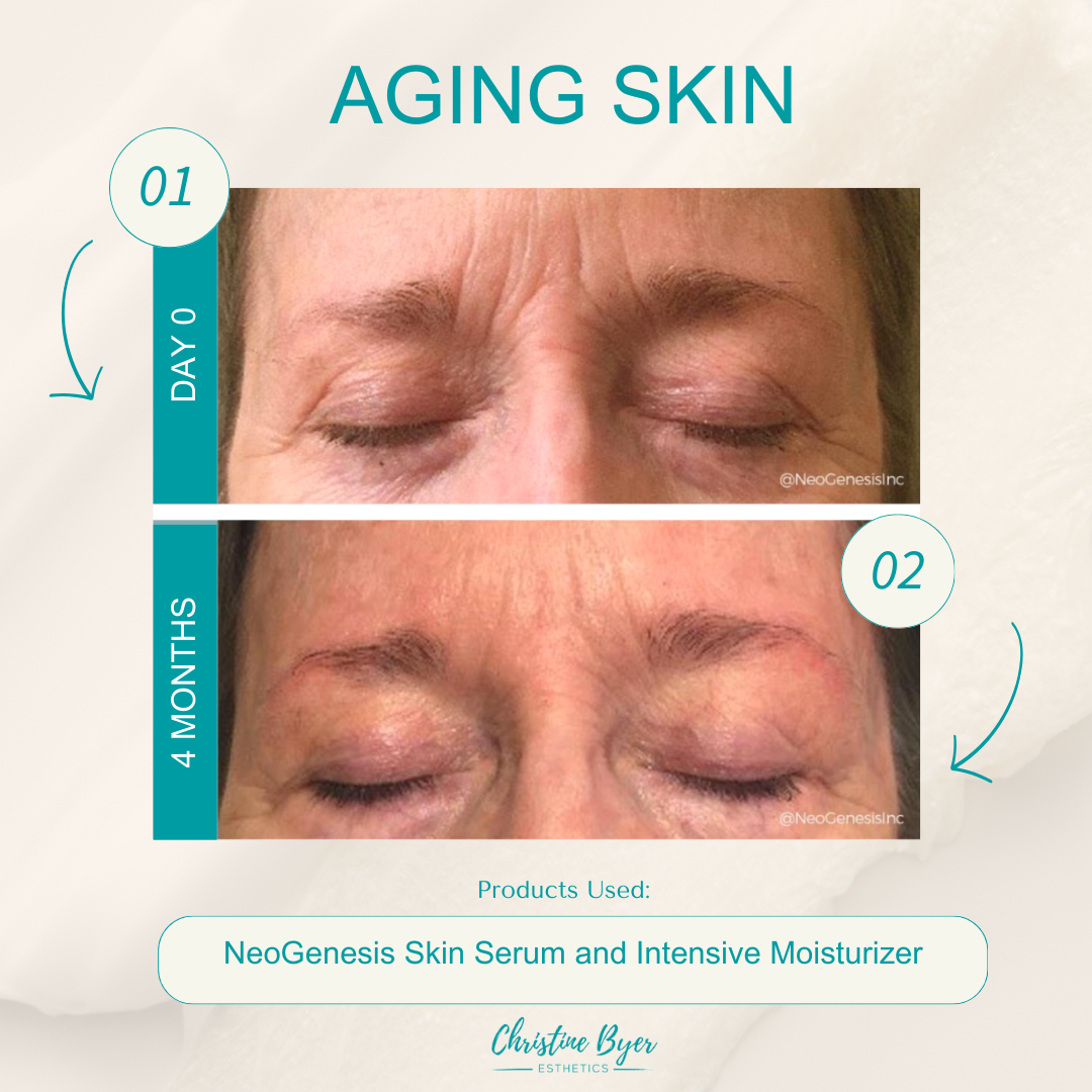 Real Results: Before and After Skin Transformations - Christine Byer ...