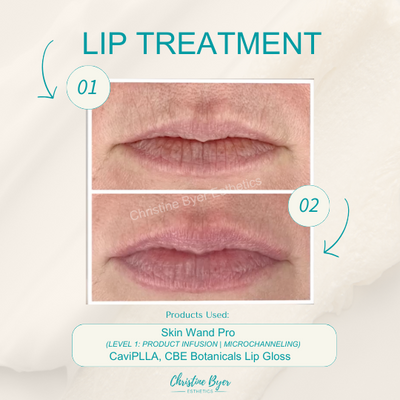 Skin Wand Pro - Christine Byer Esthetics