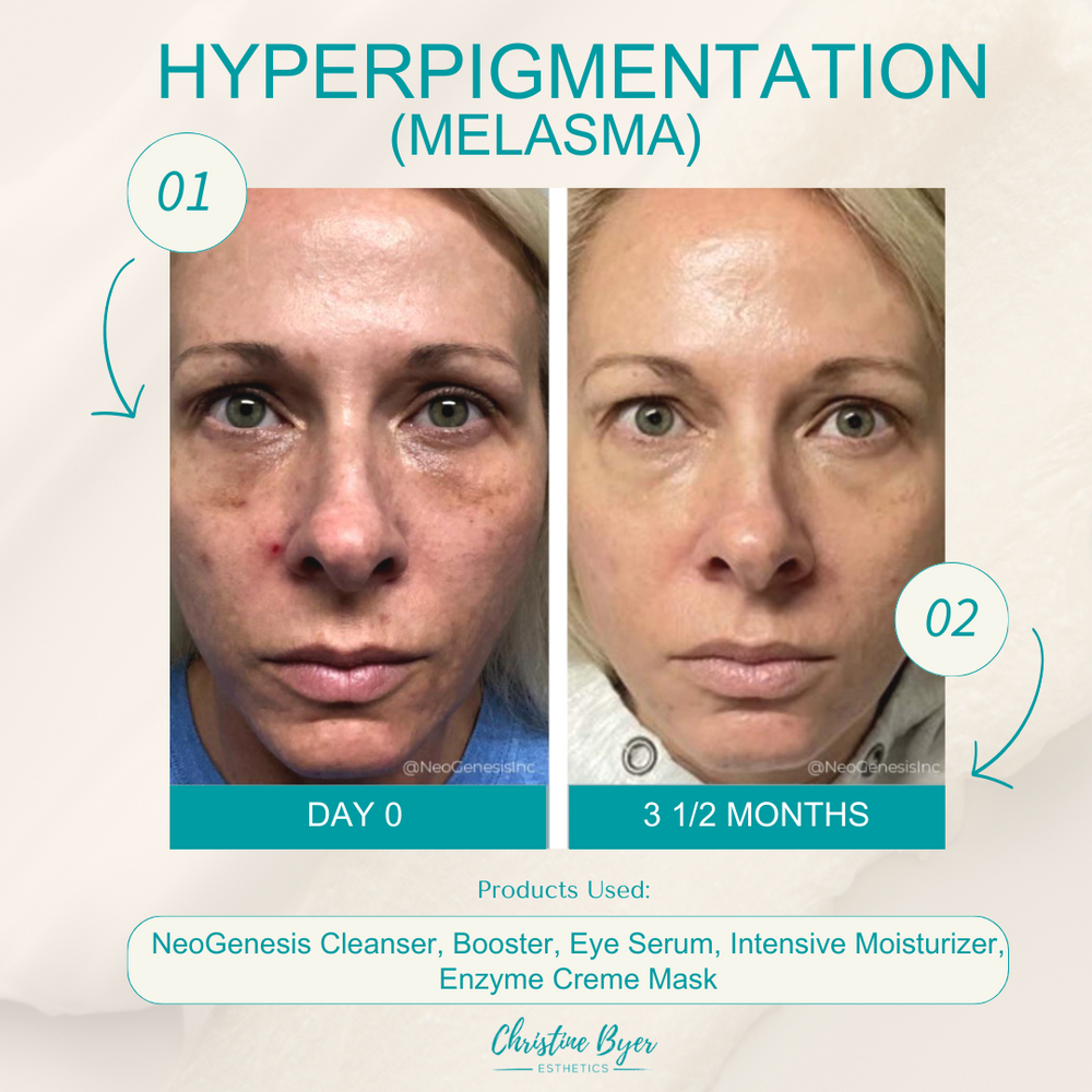 Real Results: Before and After Skin Transformations - Christine Byer ...