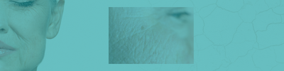 Are You Struggling with Glycated Skin? - Christine Byer Esthetics