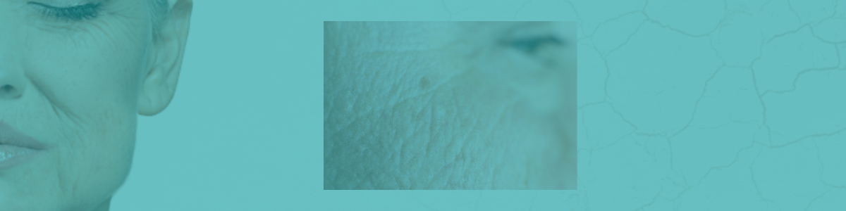 Are You Struggling with Glycated Skin? - Christine Byer Esthetics
