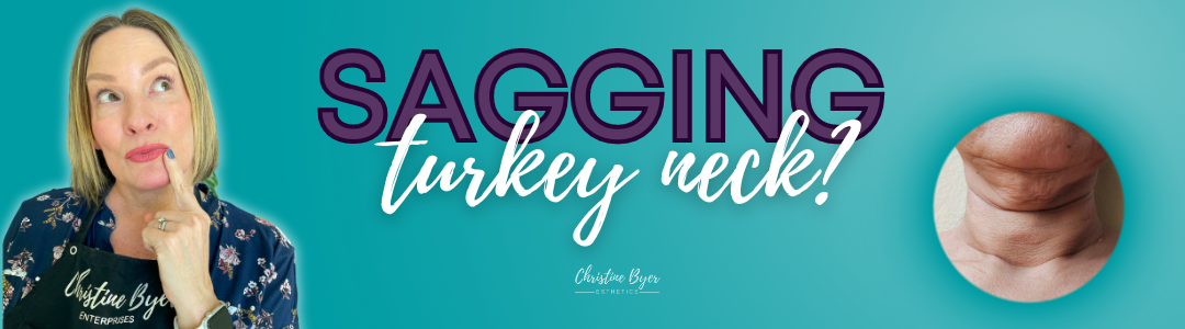 How to Fix a “Turkey” Neck - Christine Byer Esthetics