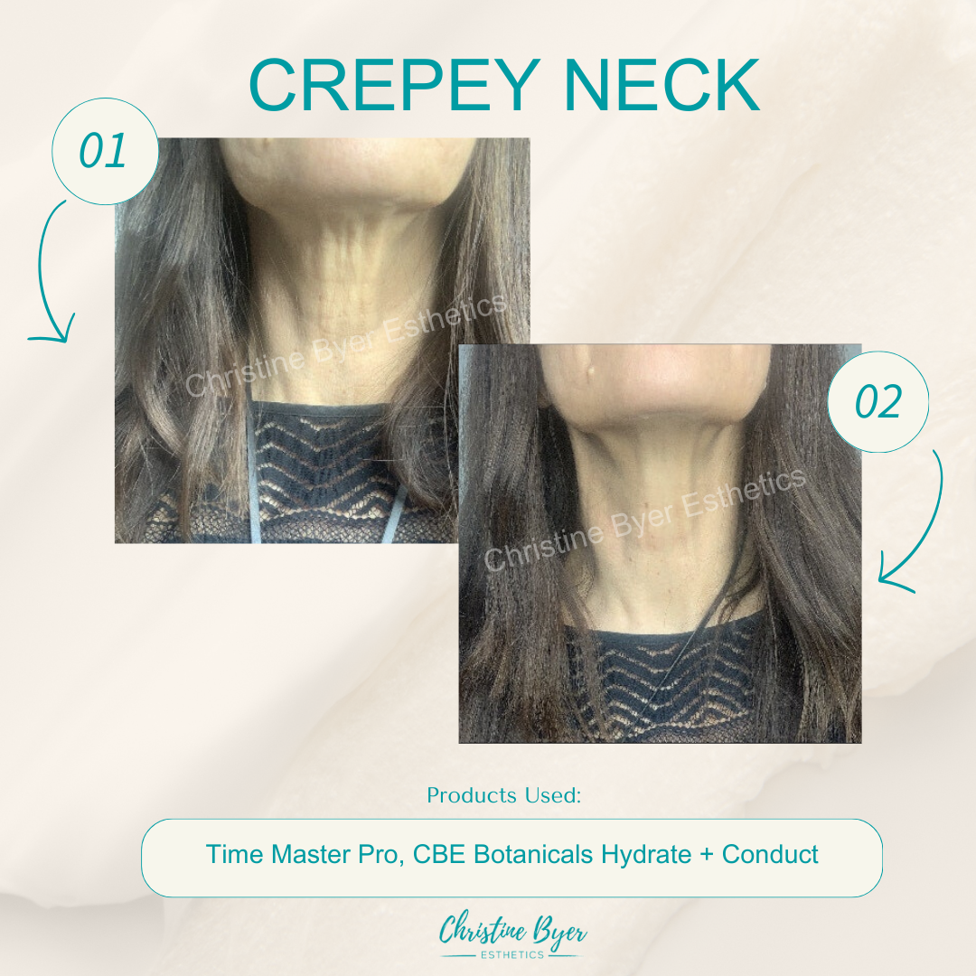 Real Results: Before and After Skin Transformations - Christine Byer ...